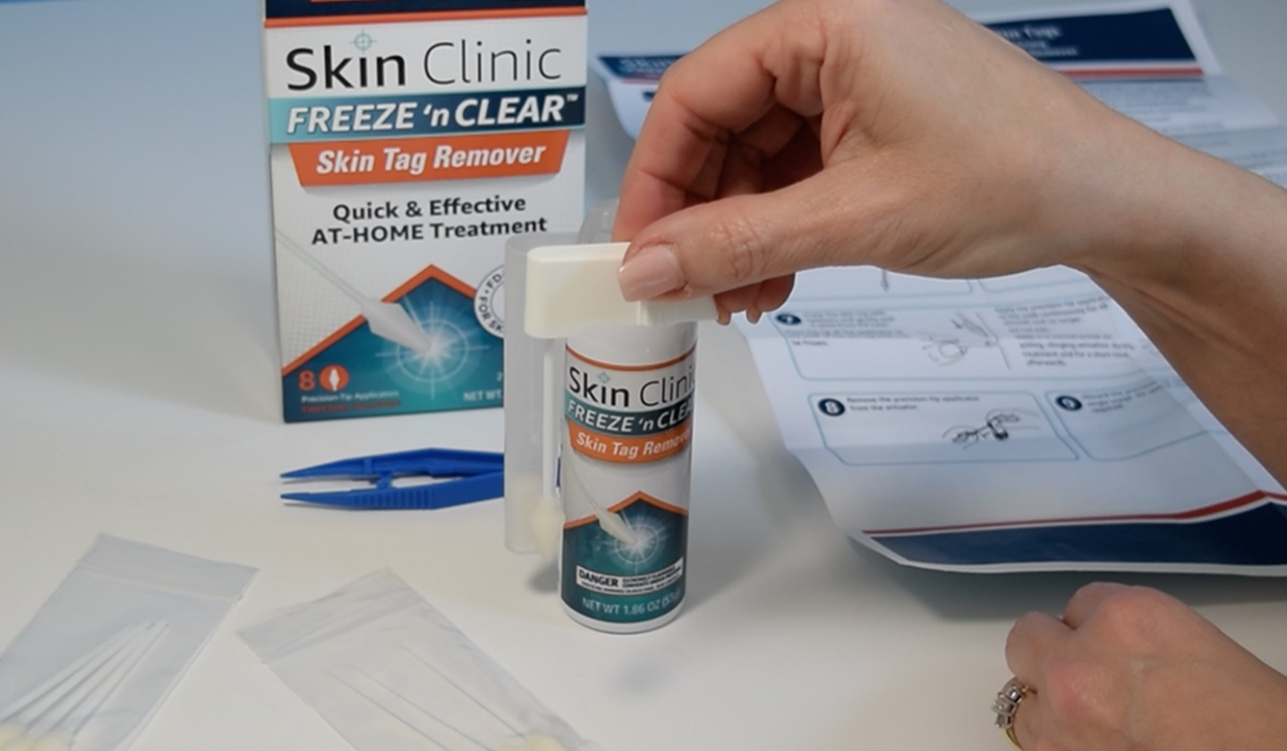 How to Get Rid of Skin Tags at Home | Shop Skin Clinic